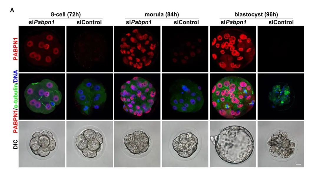 NAR | 范衡宇课题组揭示RNA结合蛋白PABPN1调控受精卵中母源mRNA降解、启动胚胎发育的新机制-药选址
